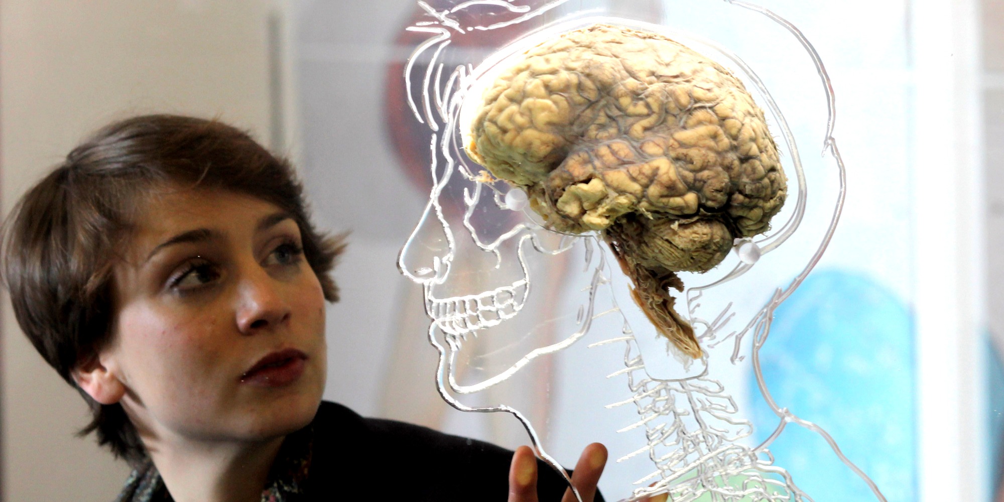 O mais completo cérebro humano cultivado em laboratório